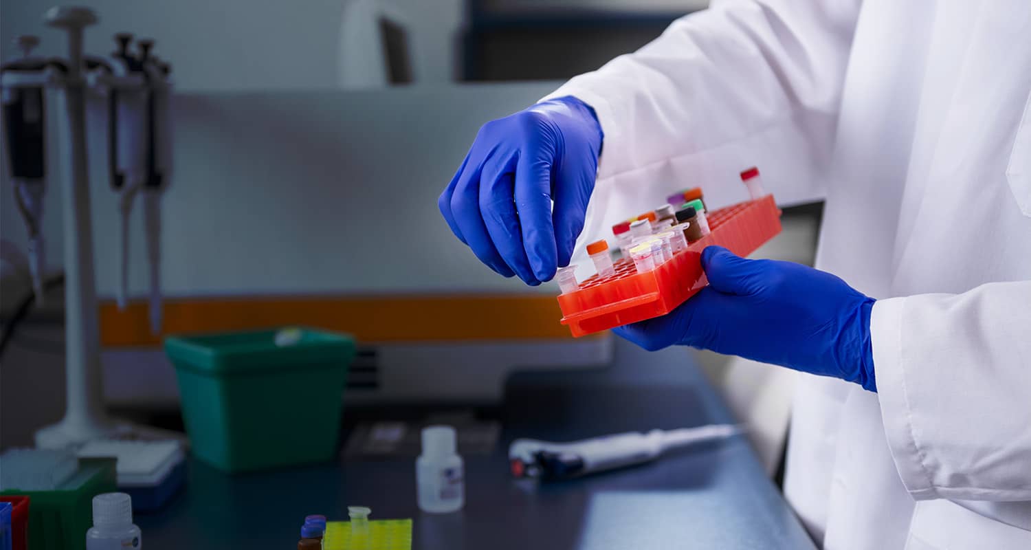 Tocris Bioscience | High Performance Life Science Reagents